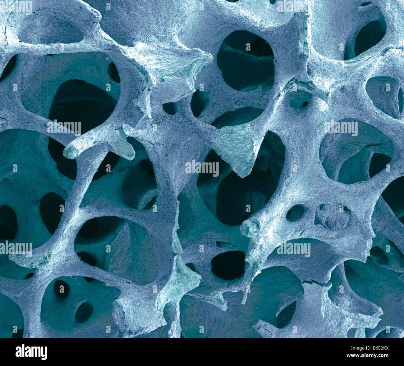 Cross Section Bone Human Stockfotos & Cross Section Bone Human Bilder ...