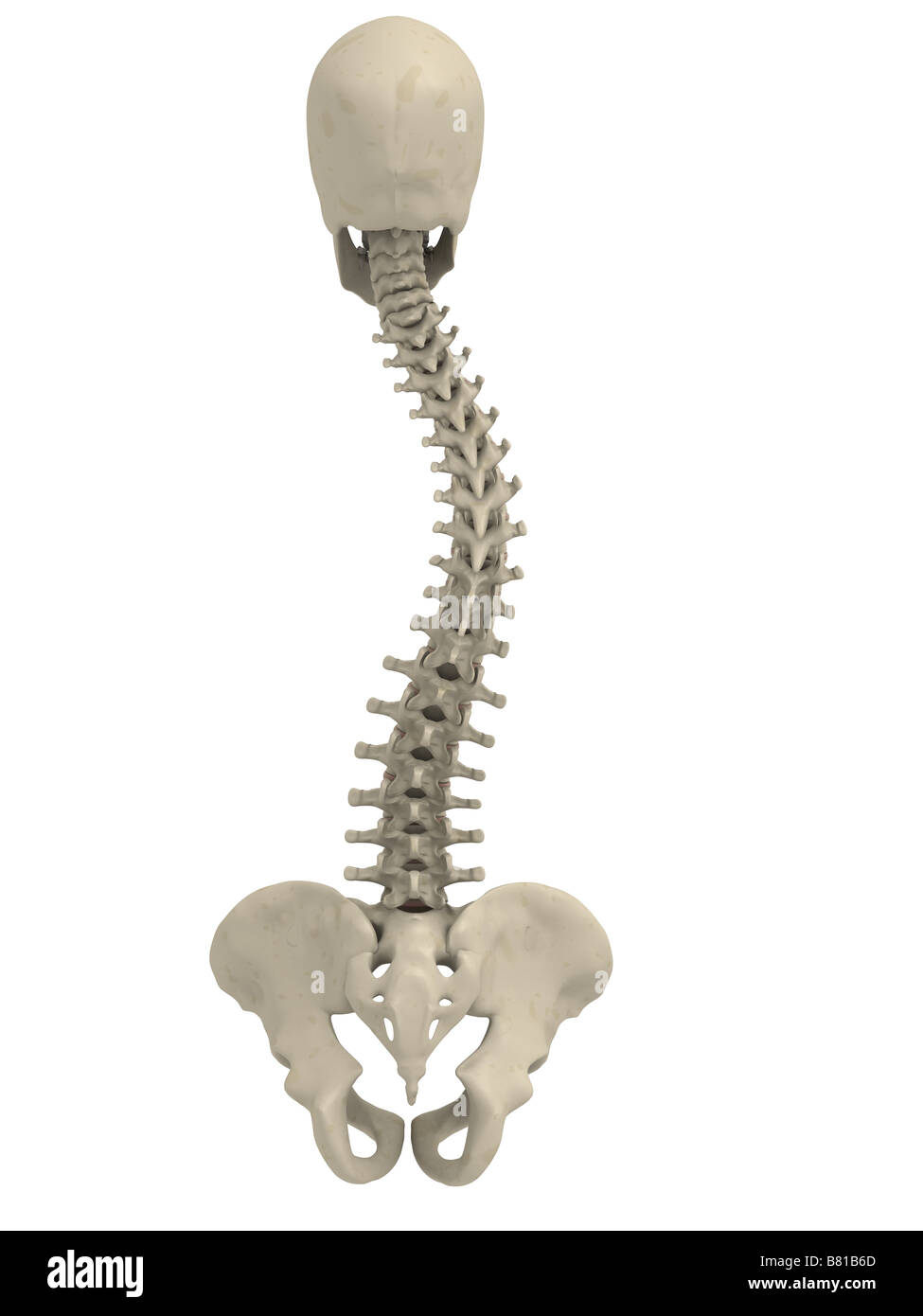 Scoliosis of the spine -Fotos und -Bildmaterial in hoher Auflösung – Alamy