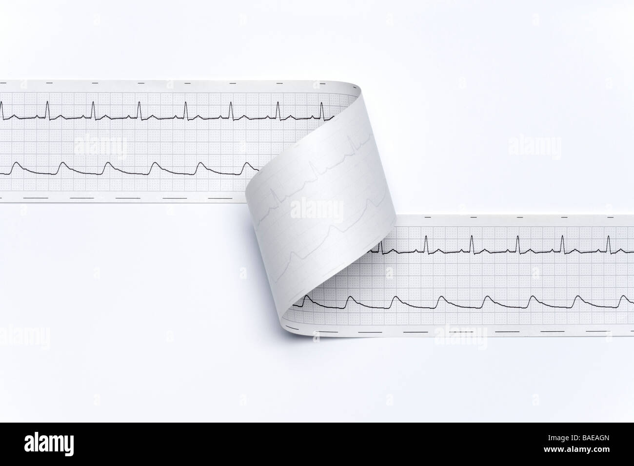 ecg -Fotos und -Bildmaterial in hoher Auflösung – Alamy
