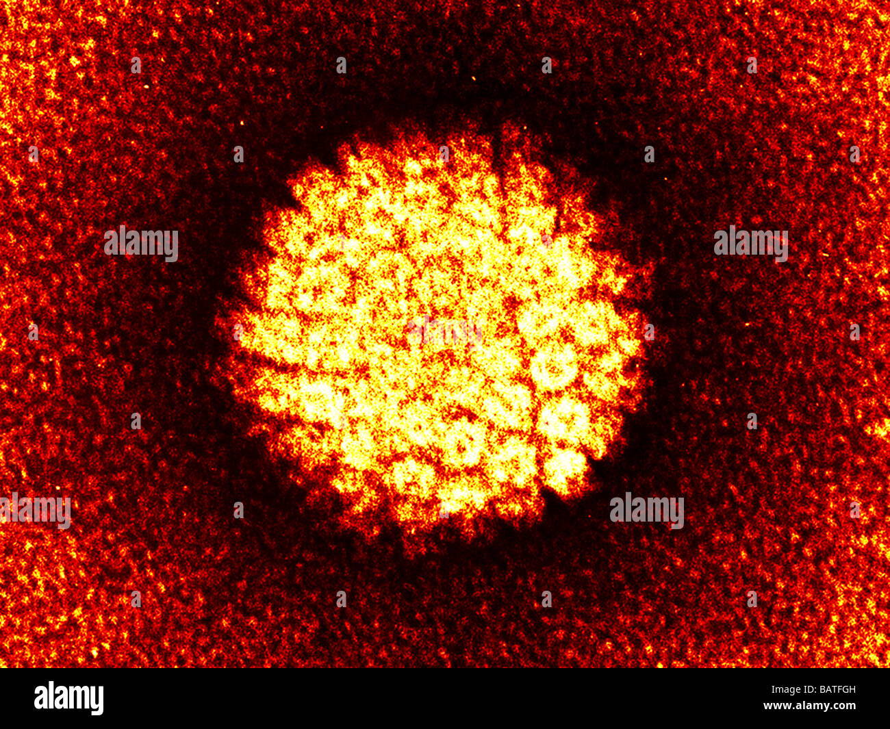 Human Papilloma Virus Hpv Stockfotos und -bilder Kaufen - Alamy