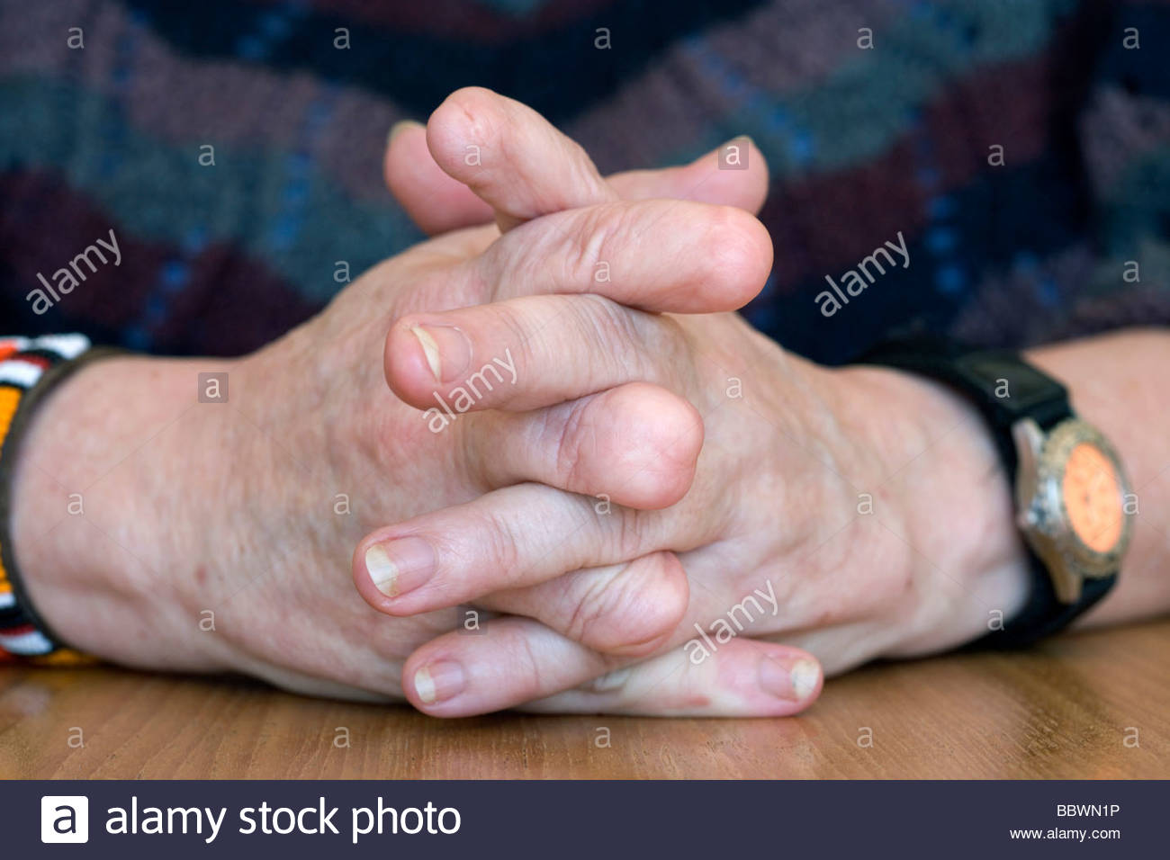 Missing Finger Stockfotos & Missing Finger Bilder - Alamy