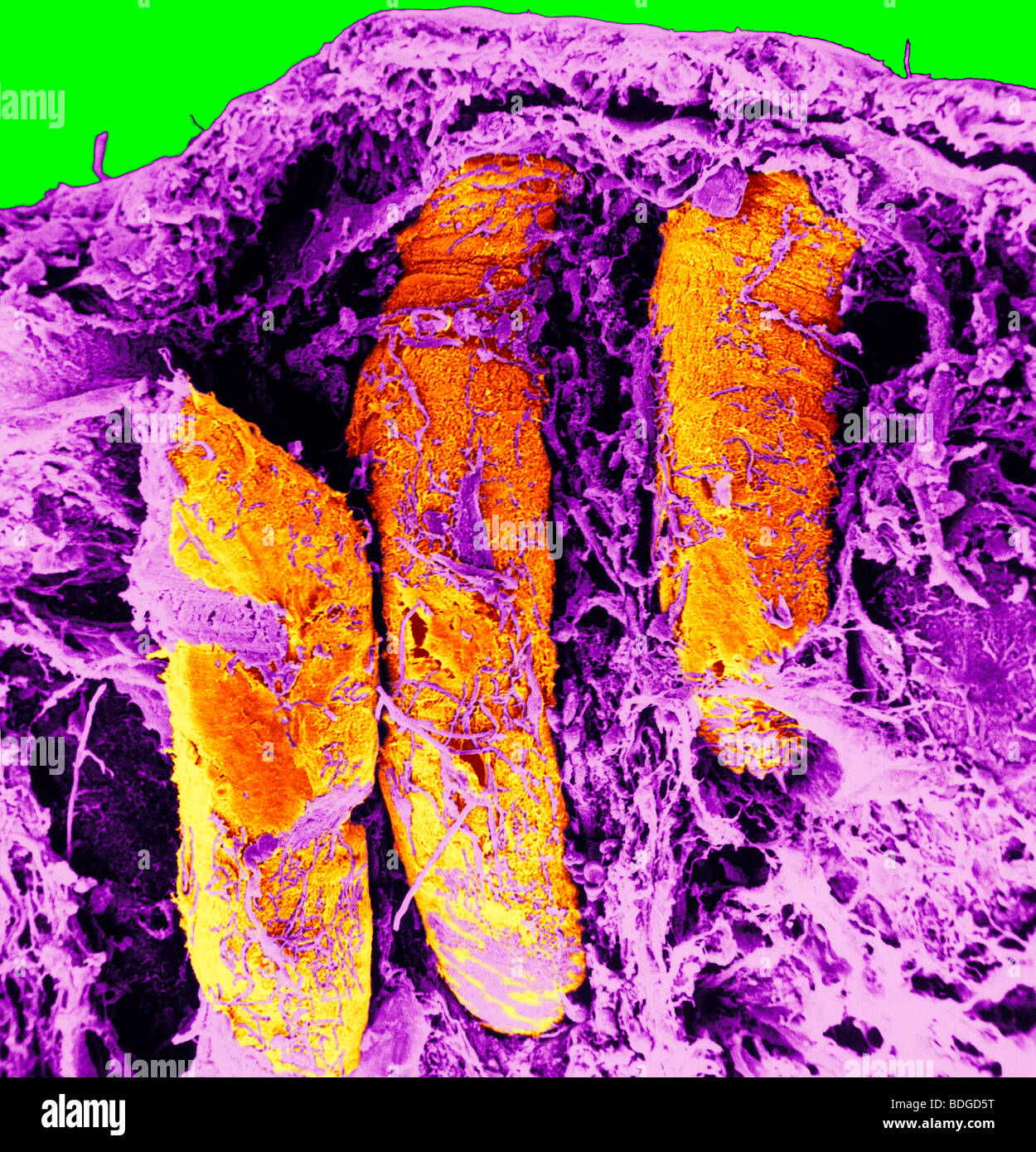Dickdarm krypten -Fotos und -Bildmaterial in hoher Auflösung – Alamy