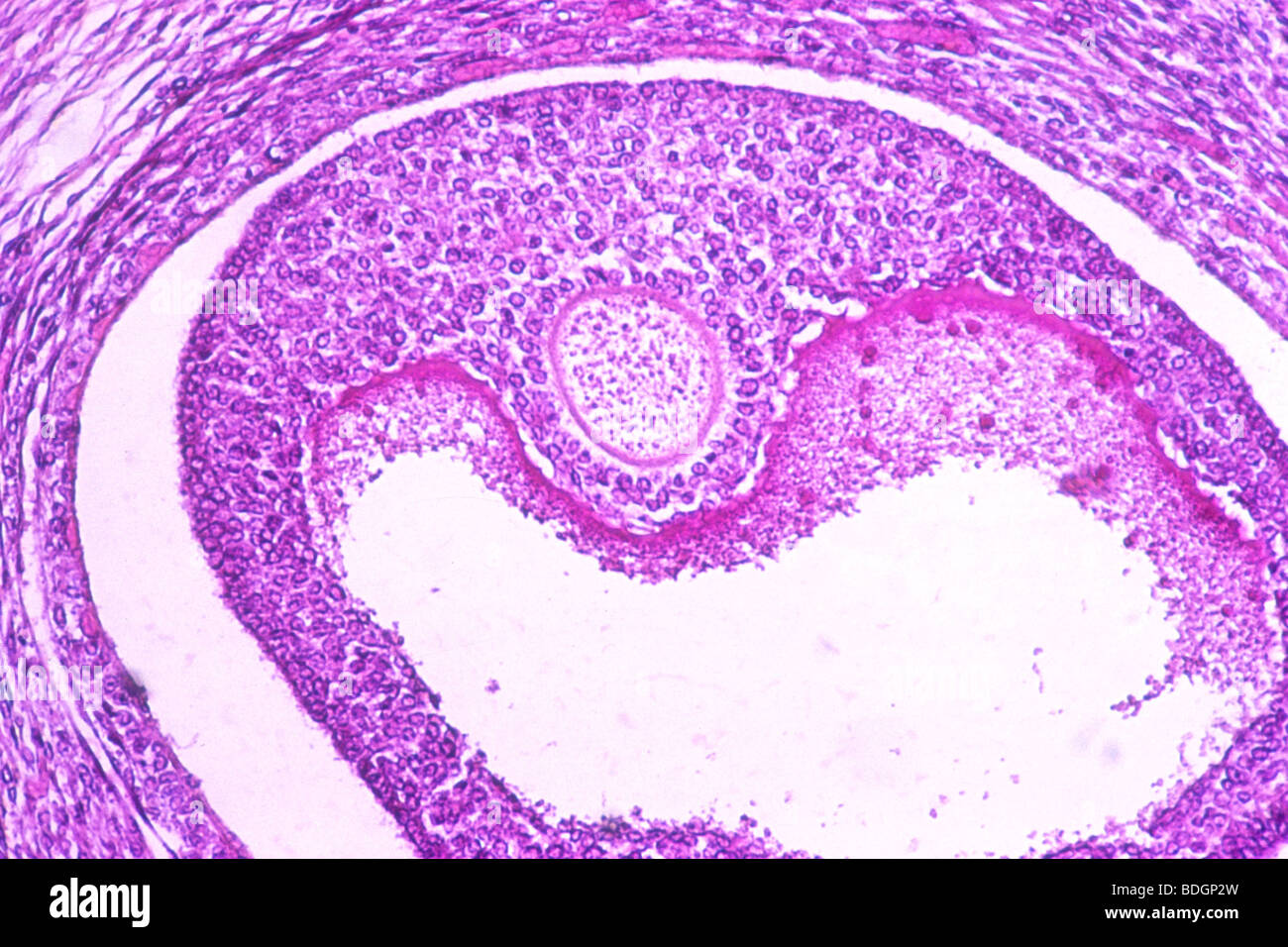 Eierstockhistologie Beschriftet