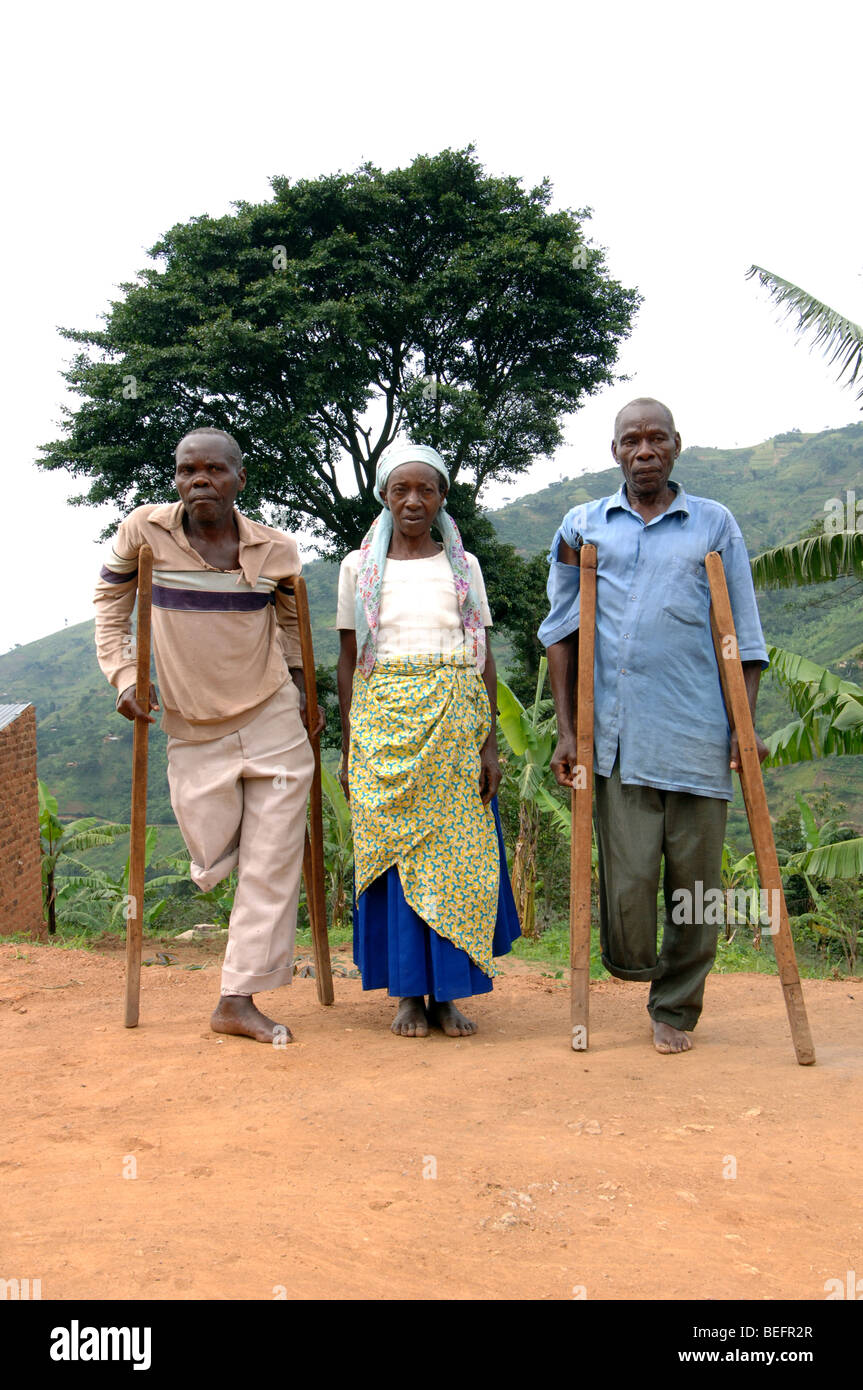 Crutches amputee -Fotos und -Bildmaterial in hoher Auflösung – Alamy