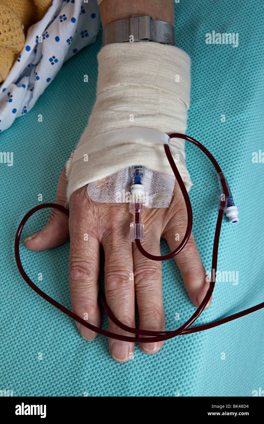 Blood Transfusion Patient Stockfotos und -bilder Kaufen - Alamy