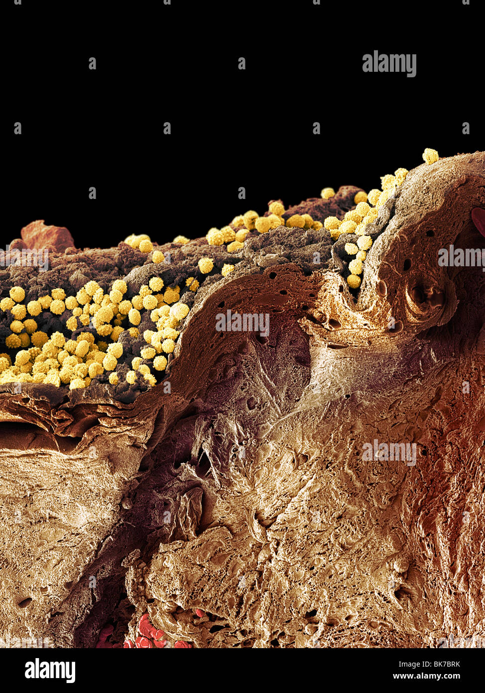 Pyoderma -Fotos und -Bildmaterial in hoher Auflösung – Alamy