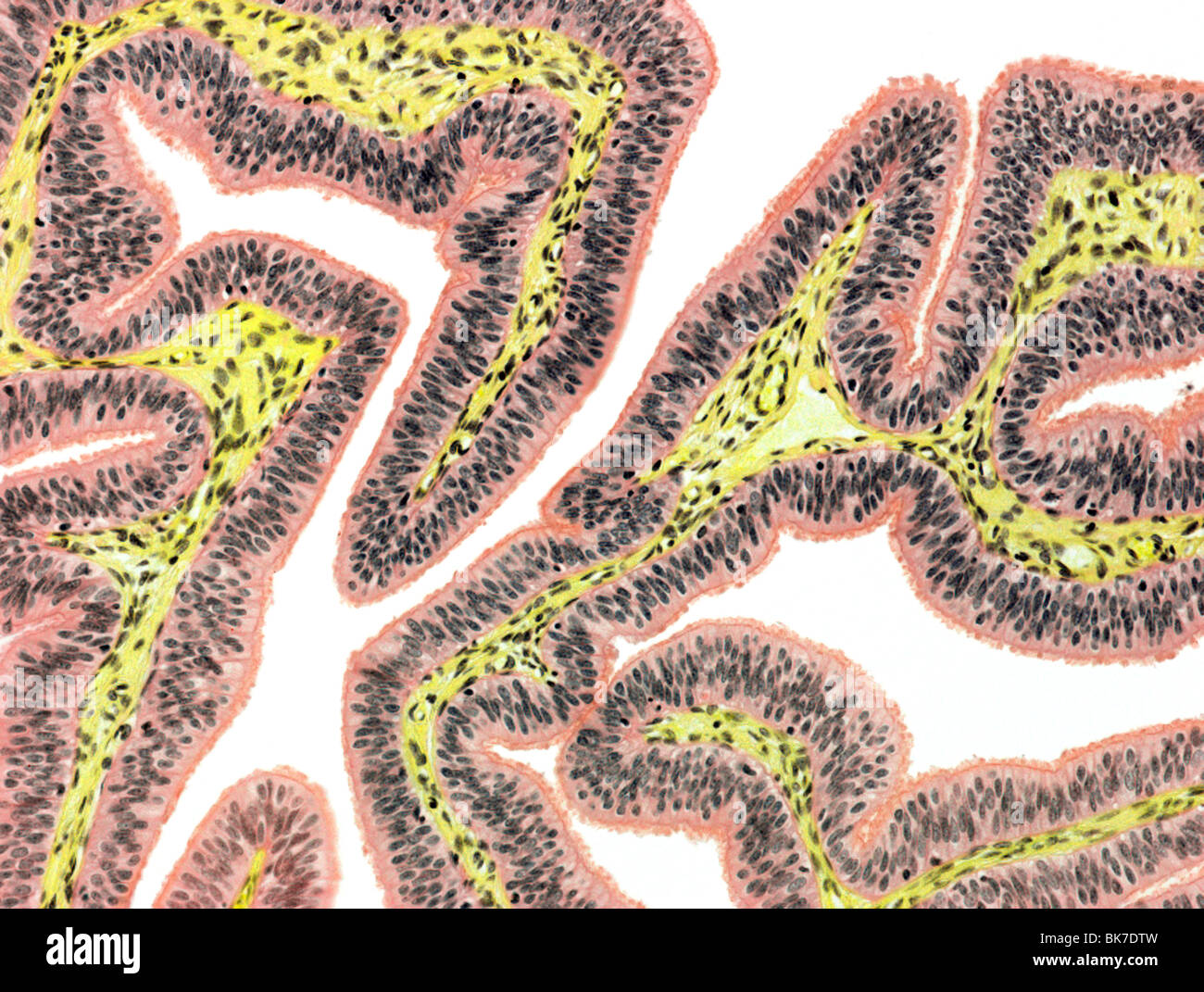 Eileiter bild -Fotos und -Bildmaterial in hoher Auflösung – Alamy