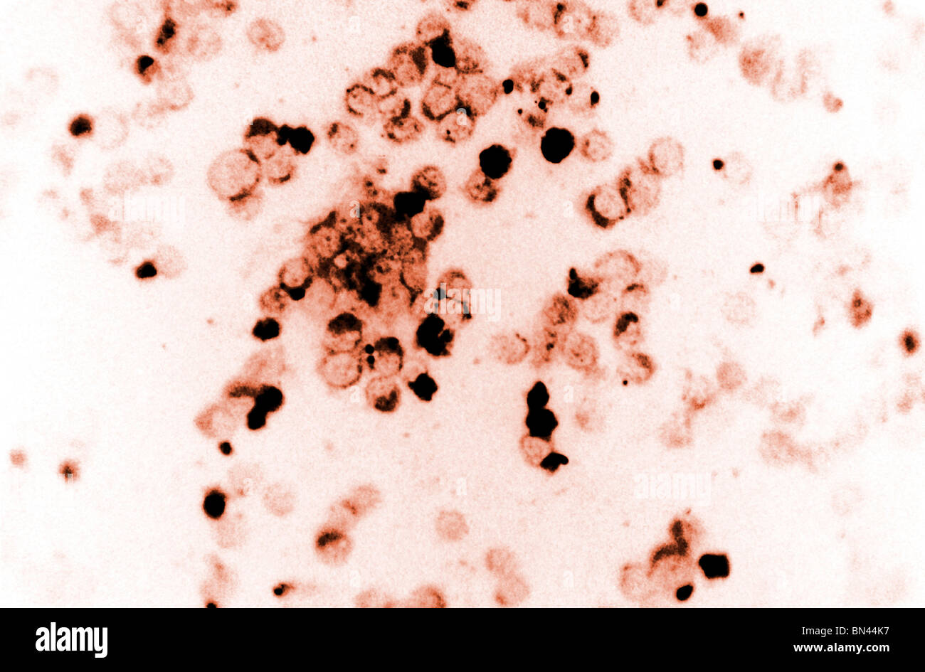 Respiratory Syncytial Virus Stockfotos und -bilder Kaufen - Alamy