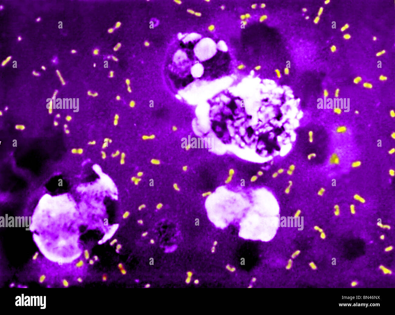 Bubonic plague -Fotos und -Bildmaterial in hoher Auflösung – Alamy