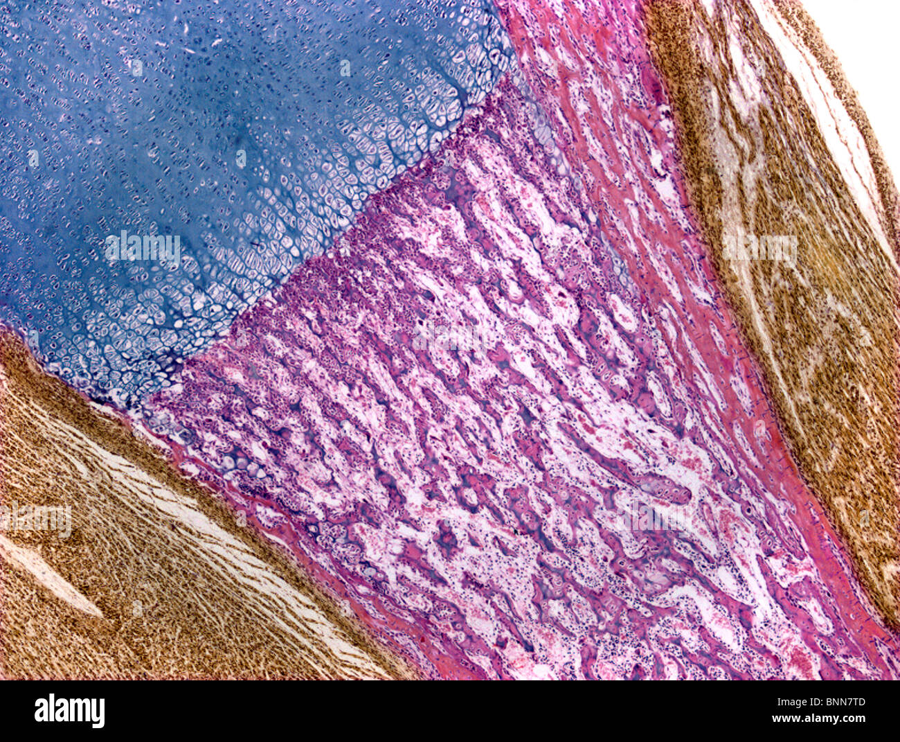 Bone Light Micrograph Stockfotos und -bilder Kaufen - Alamy