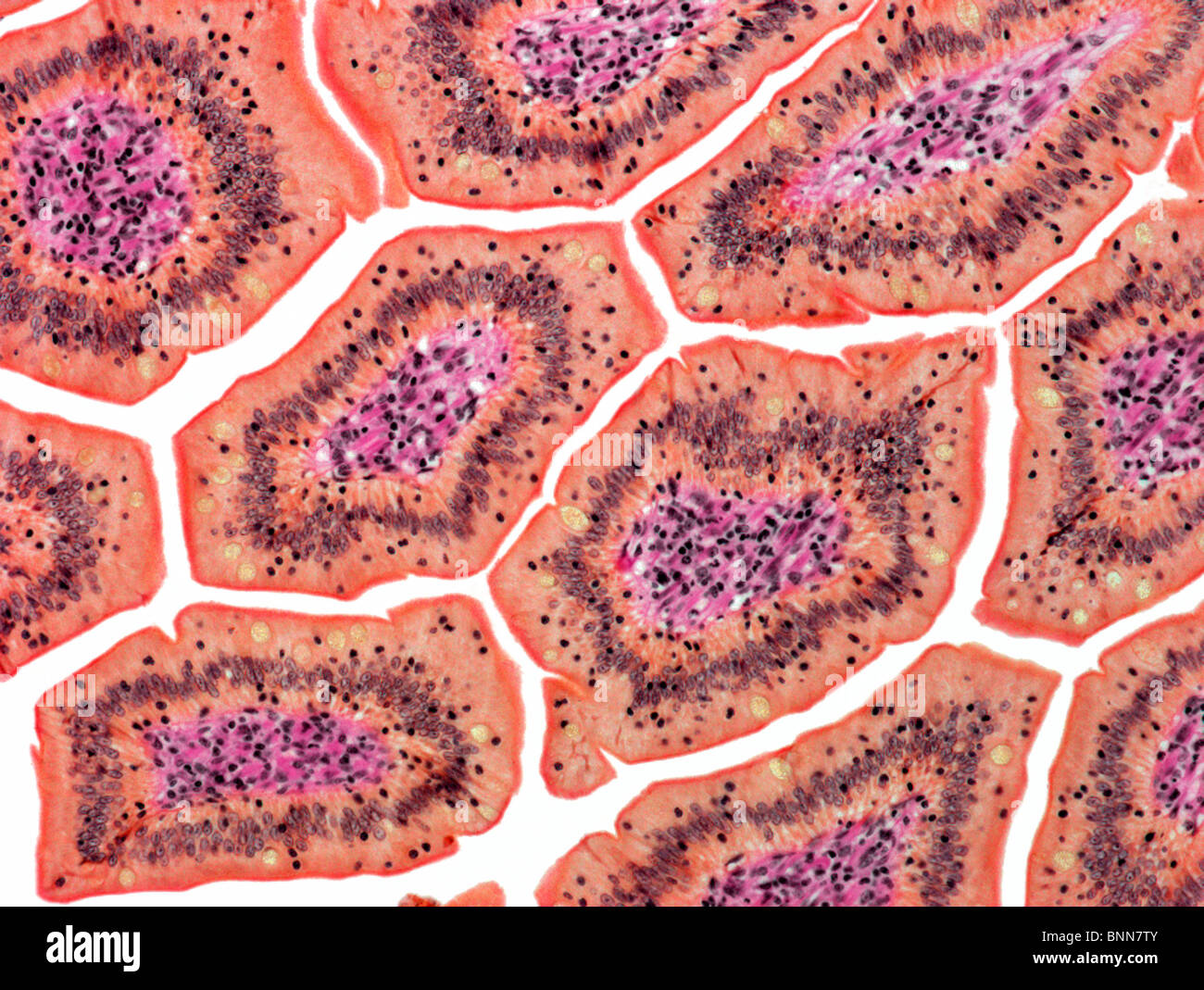 Intestine villi micrograph -Fotos und -Bildmaterial in hoher Auflösung ...