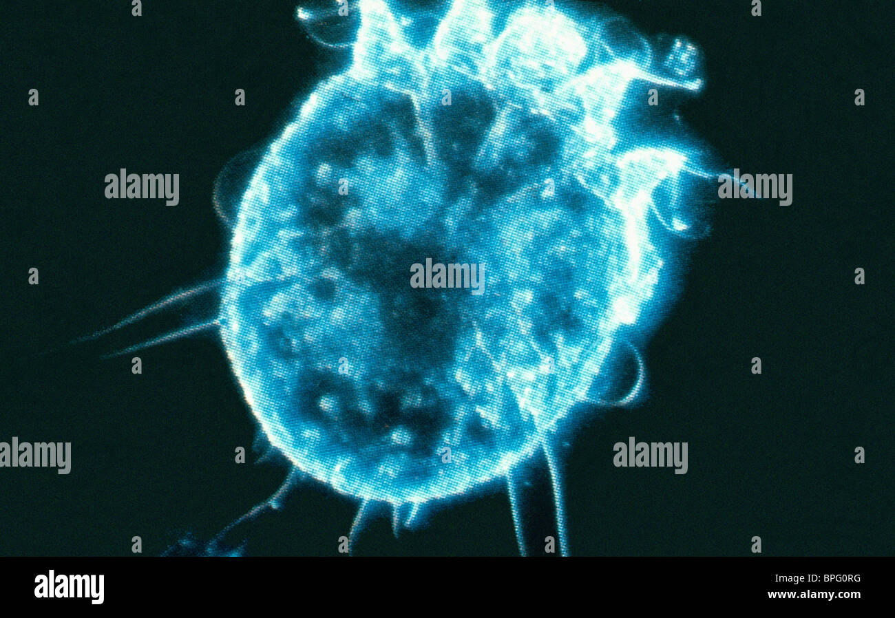 Mikrophotographie Milbe, Sarcoptes Scabei, ein Parasit der menschlichen ...