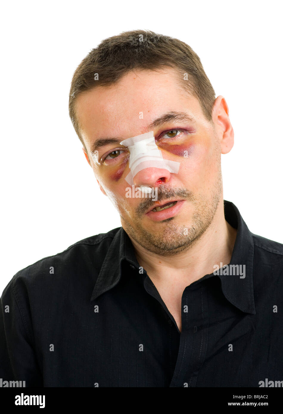 Gebrochene nase -Fotos und -Bildmaterial in hoher Auflösung – Alamy