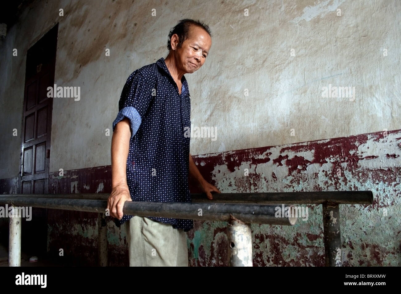 Amputation Amputation Amputiert Stockfotos und -bilder Kaufen - Alamy