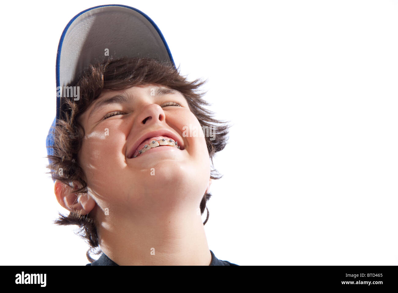 Zahnspangen headgear -Fotos und -Bildmaterial in hoher Auflösung – Alamy