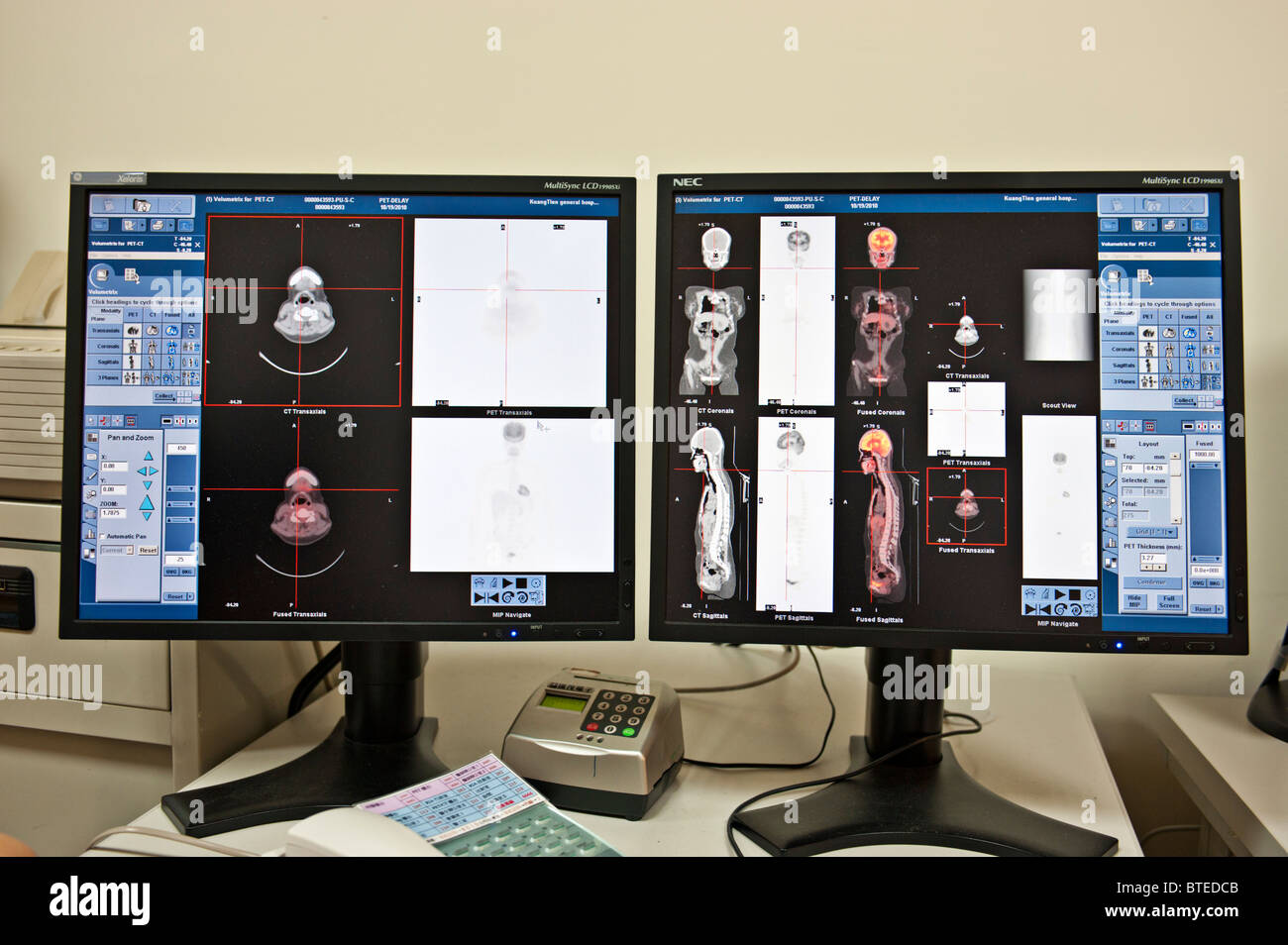 Computertomographie ct -Fotos und -Bildmaterial in hoher Auflösung – Alamy