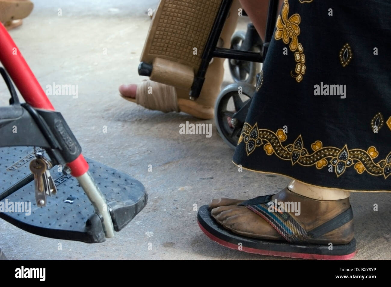 Weiblichen amputierten -Fotos und -Bildmaterial in hoher Auflösung – Alamy