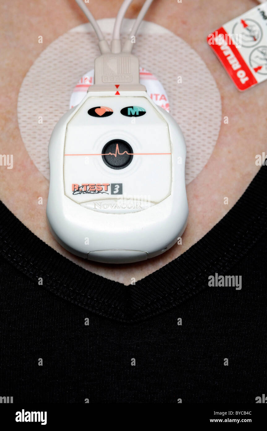 Monitor ekg -Fotos und -Bildmaterial in hoher Auflösung – Alamy