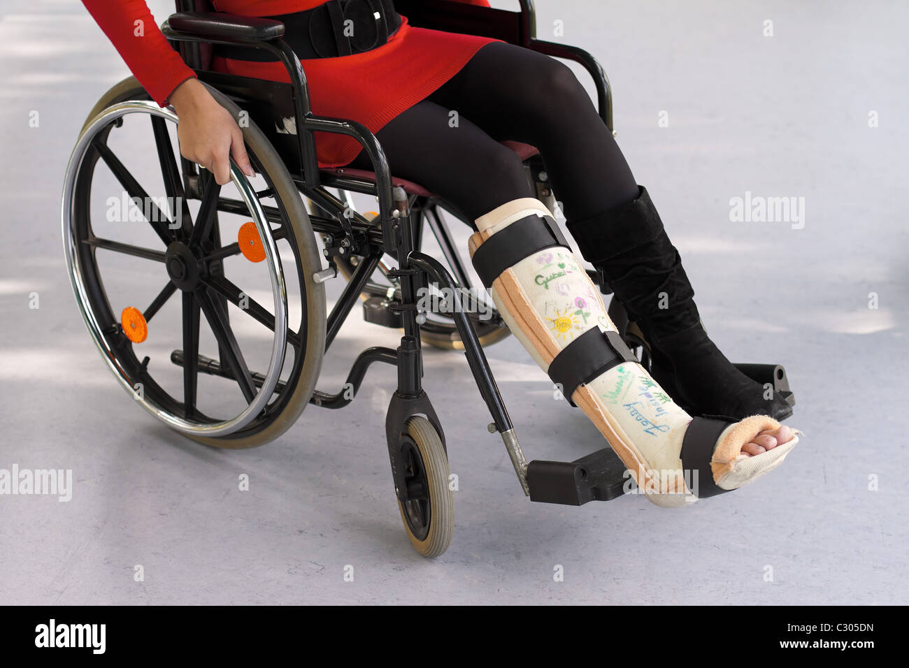 Frau mit Gipsbein Stockfotografie - Alamy