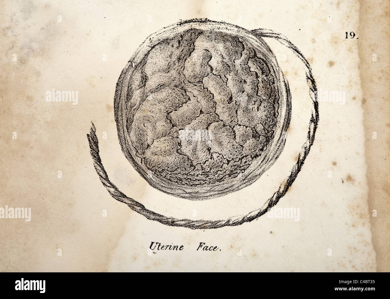 Abbildung der menschlichen Plazenta copyright 1844 Stockfotografie - Alamy