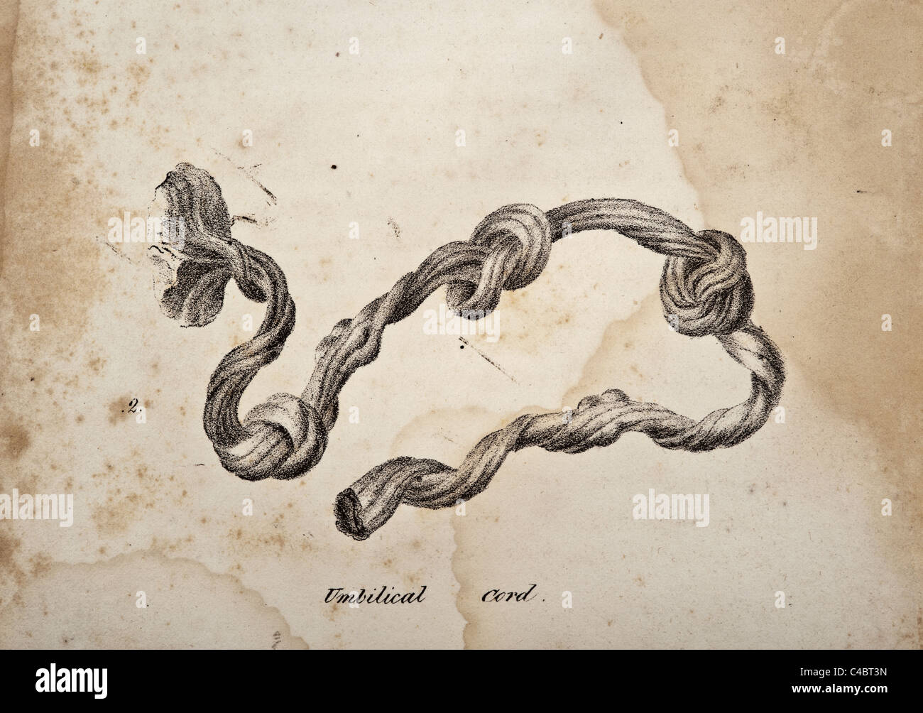 Abbildung der menschlichen Plazenta copyright 1844 Stockfotografie - Alamy