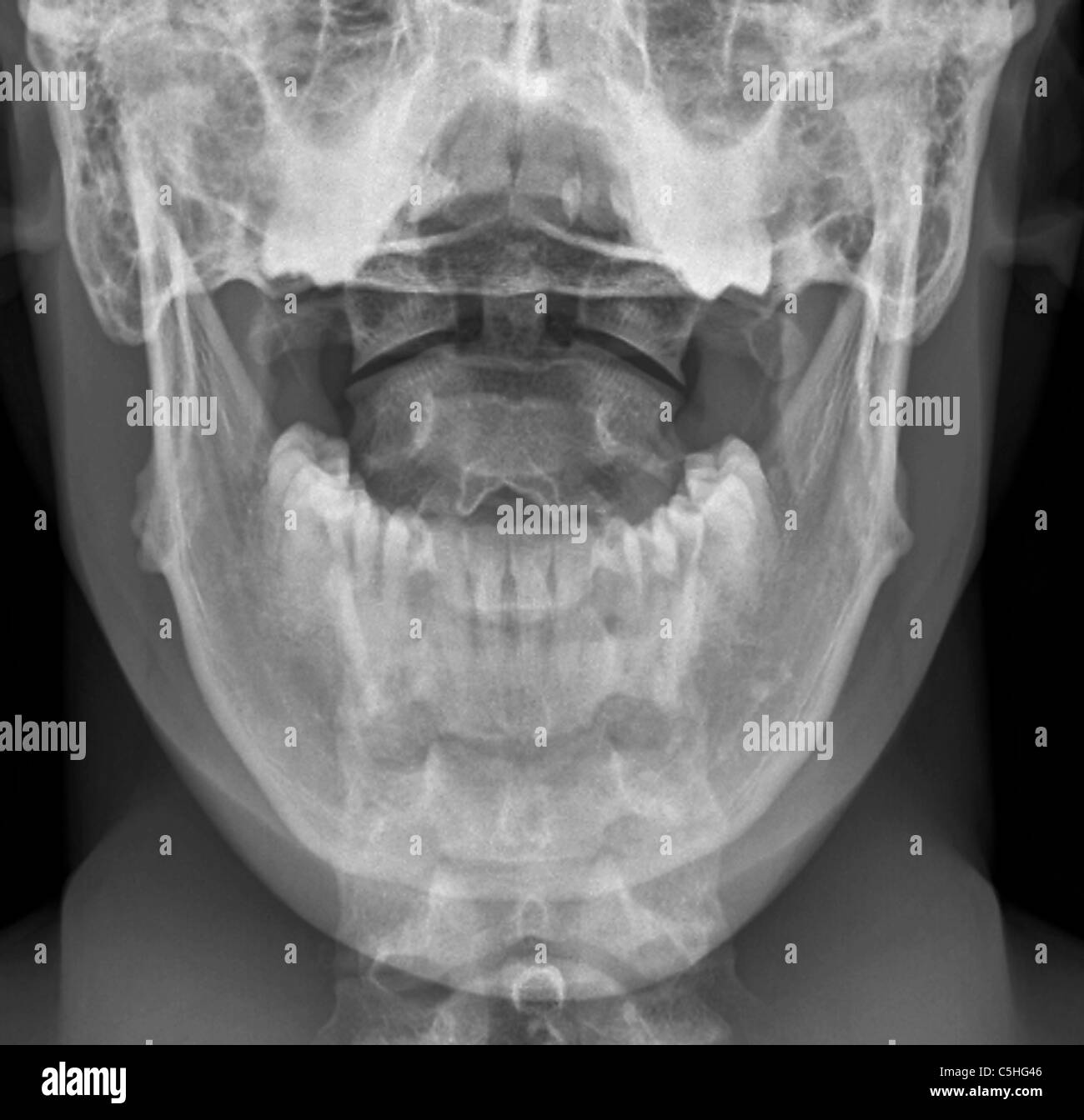 Anatomie kopf hals wissenschaften -Fotos und -Bildmaterial in hoher ...