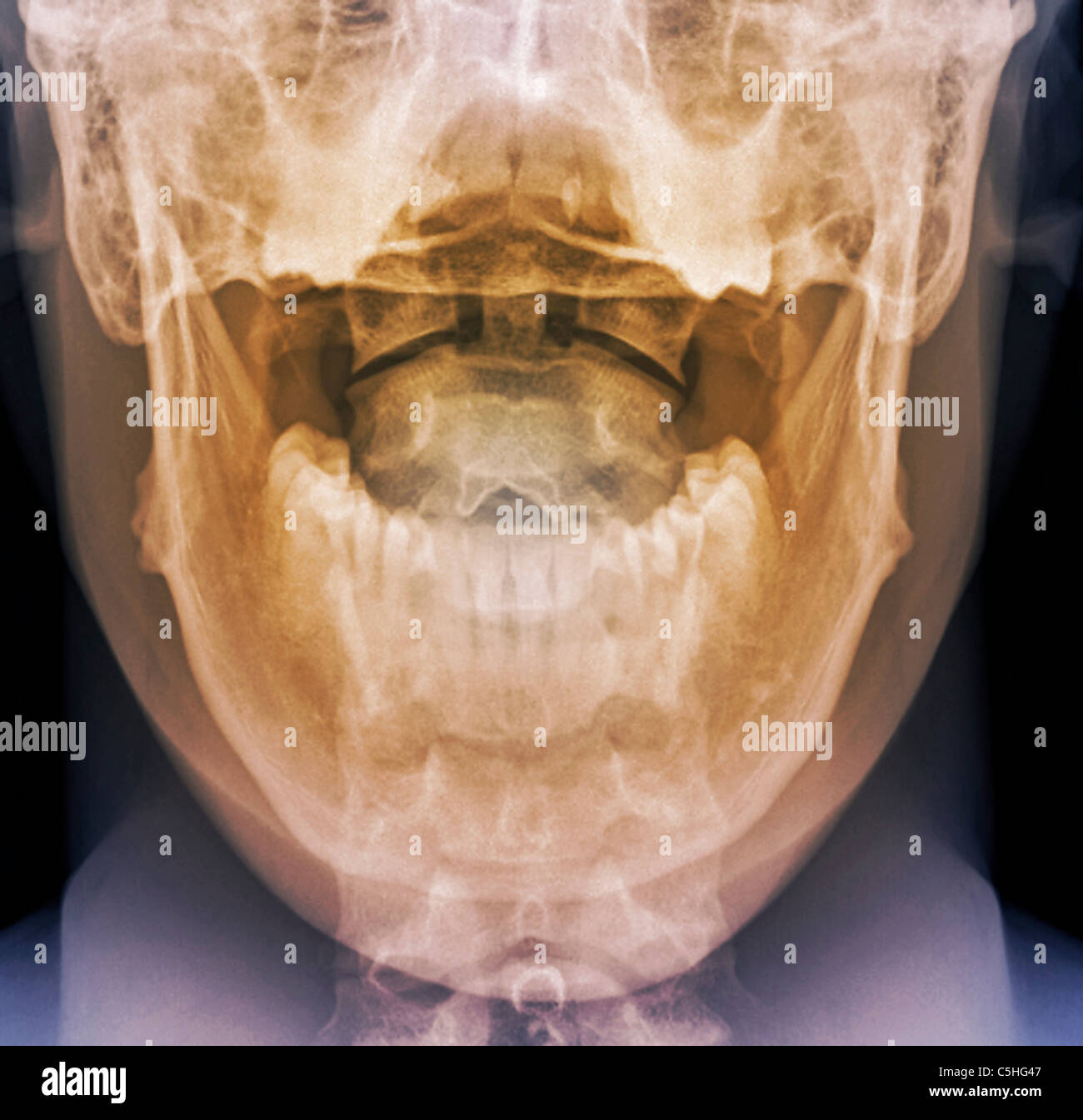 Anatomie kopf hals wissenschaften -Fotos und -Bildmaterial in hoher ...