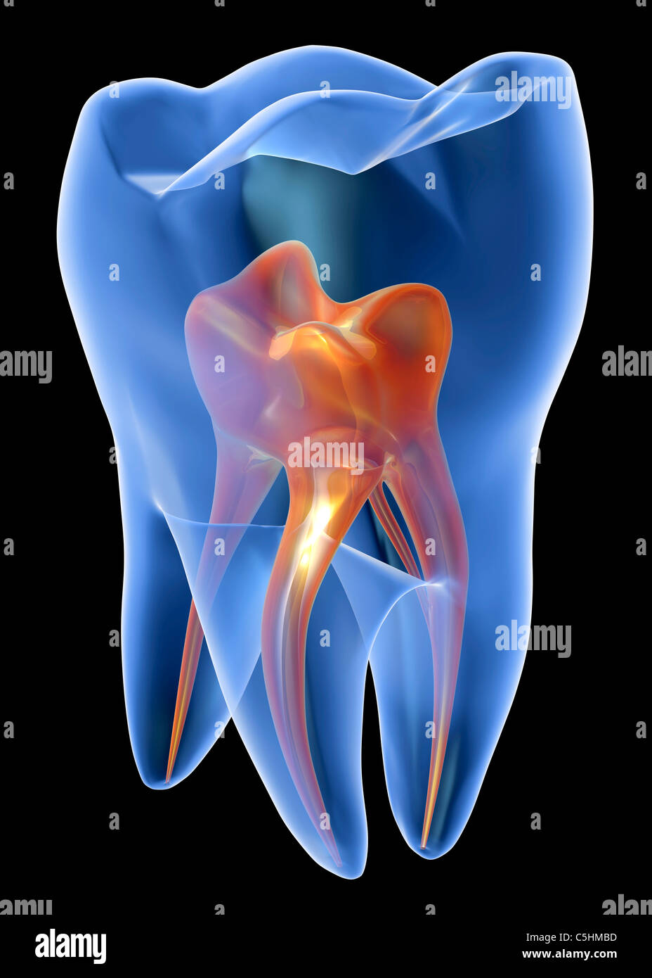 Molar tooth pulp chamber -Fotos und -Bildmaterial in hoher Auflösung ...