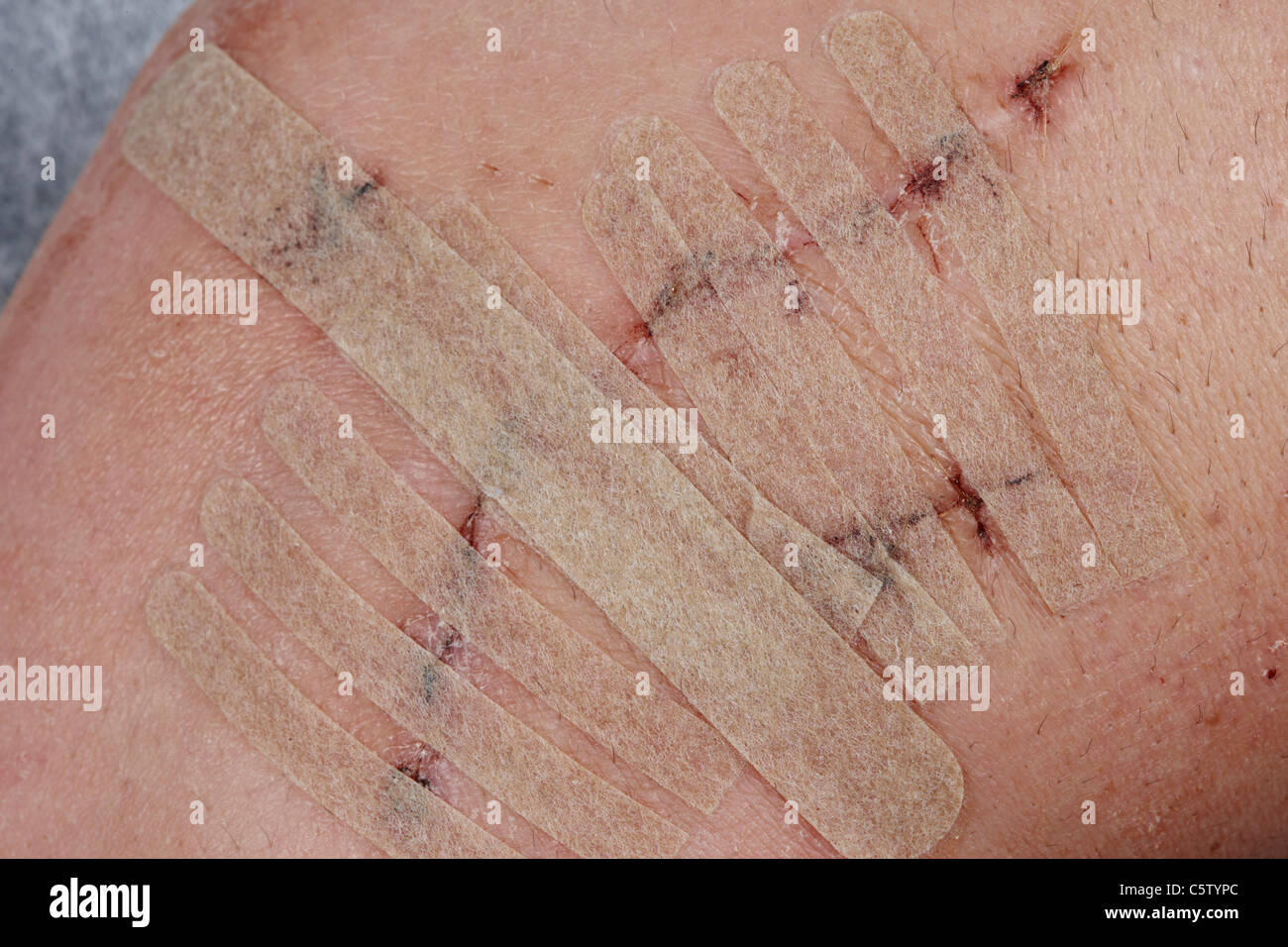 Verschweisste Naht, close-up Stockfotografie - Alamy