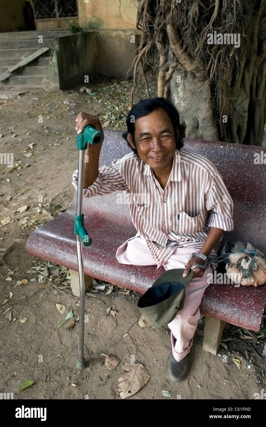 Amputation amputee -Fotos und -Bildmaterial in hoher Auflösung – Alamy