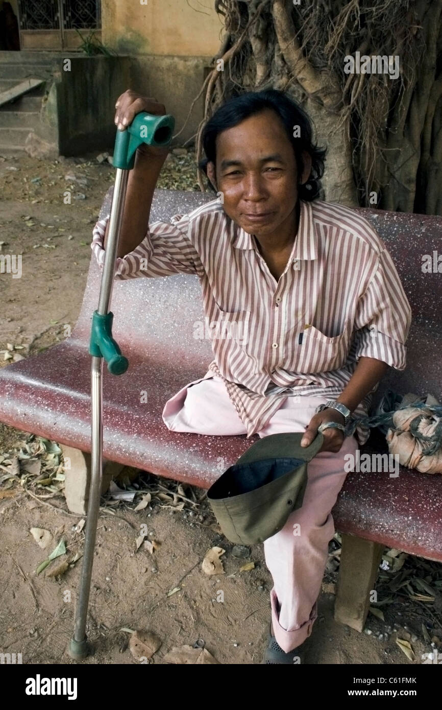 Amputation amputee -Fotos und -Bildmaterial in hoher Auflösung – Alamy