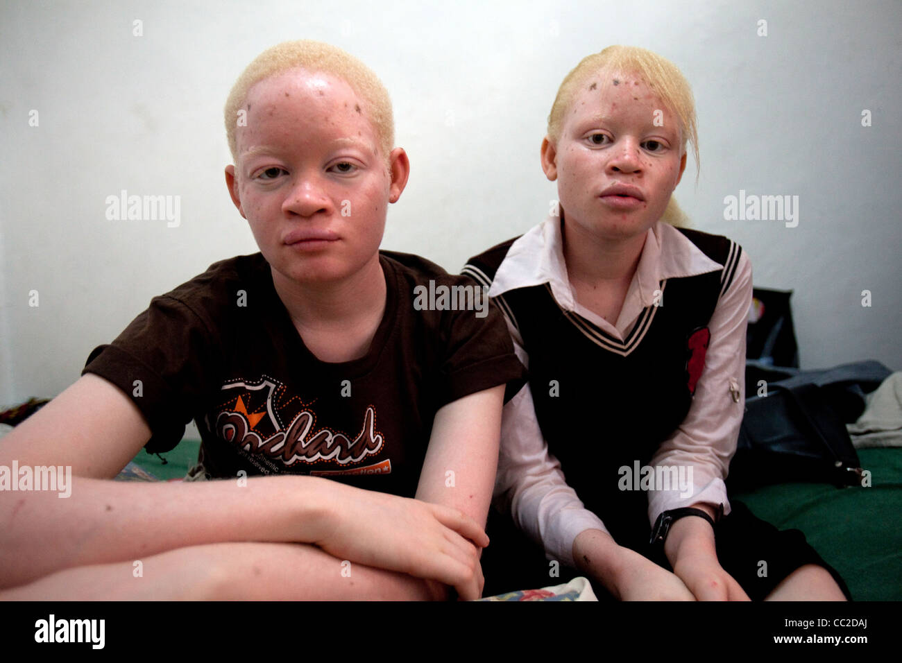 Albinos von afrika -Fotos und -Bildmaterial in hoher Auflösung – Alamy