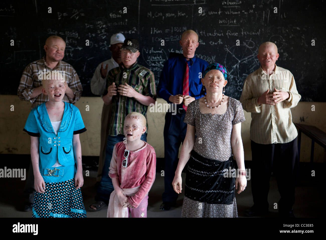 Menschen mit Albinismus in Tansania Stockfotografie - Alamy