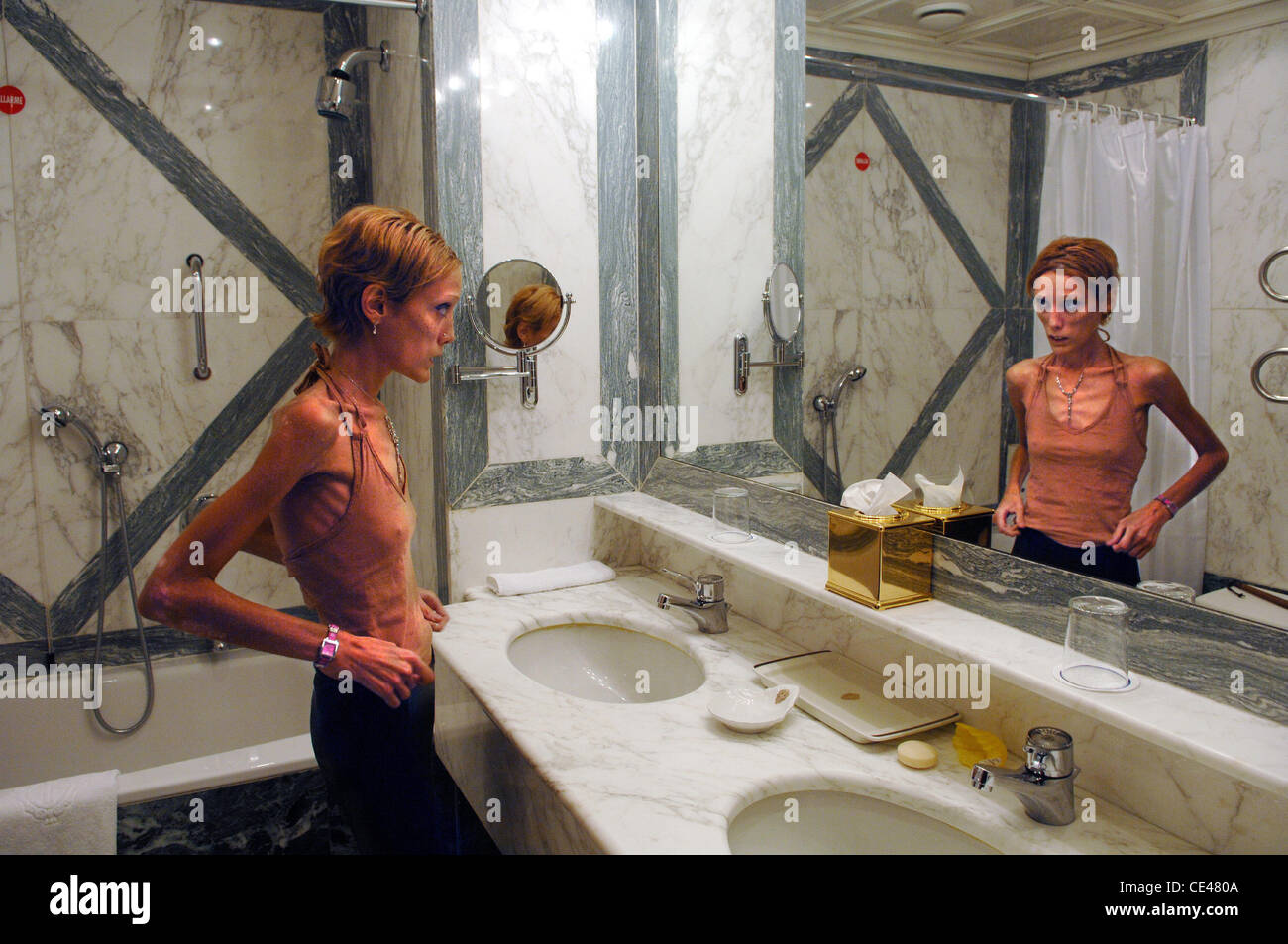 * Datei Foto * Magersüchtigen Model stirbt Caro bei 28 gestorben ist Isabelle Caro, das ...