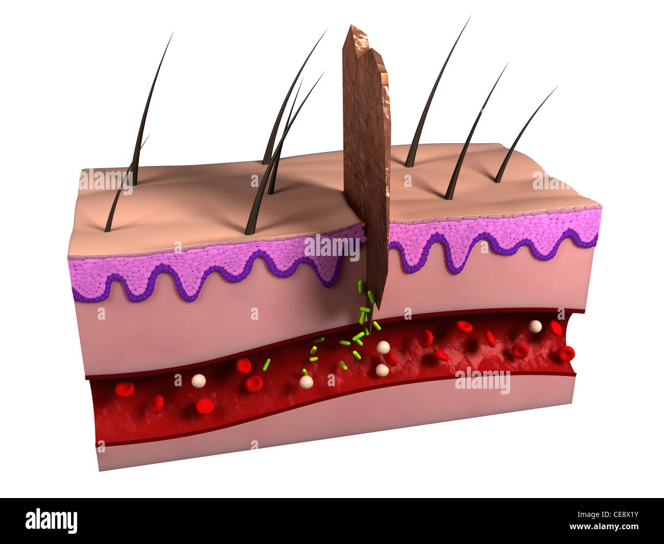 Wound Infection Stockfotos und -bilder Kaufen - Alamy