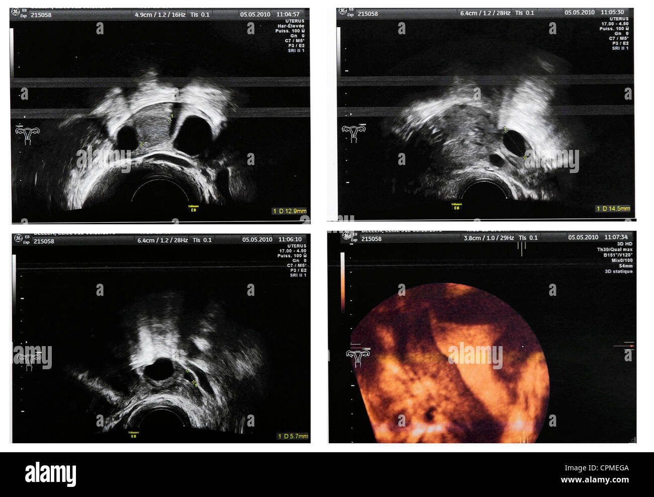 Ovarian cycle -Fotos und -Bildmaterial in hoher Auflösung – Alamy