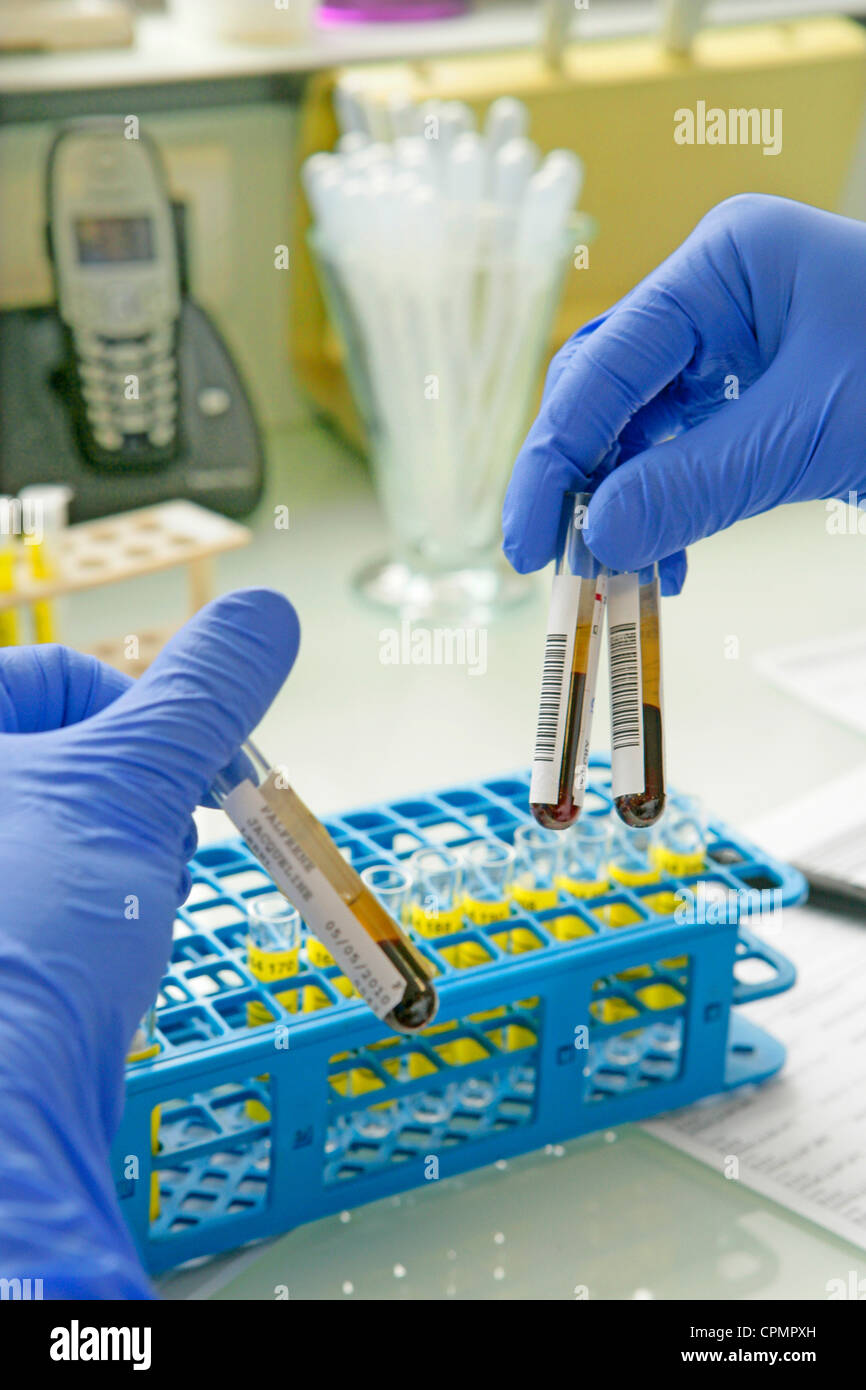 Blutserum röhrchen -Fotos und -Bildmaterial in hoher Auflösung – Alamy