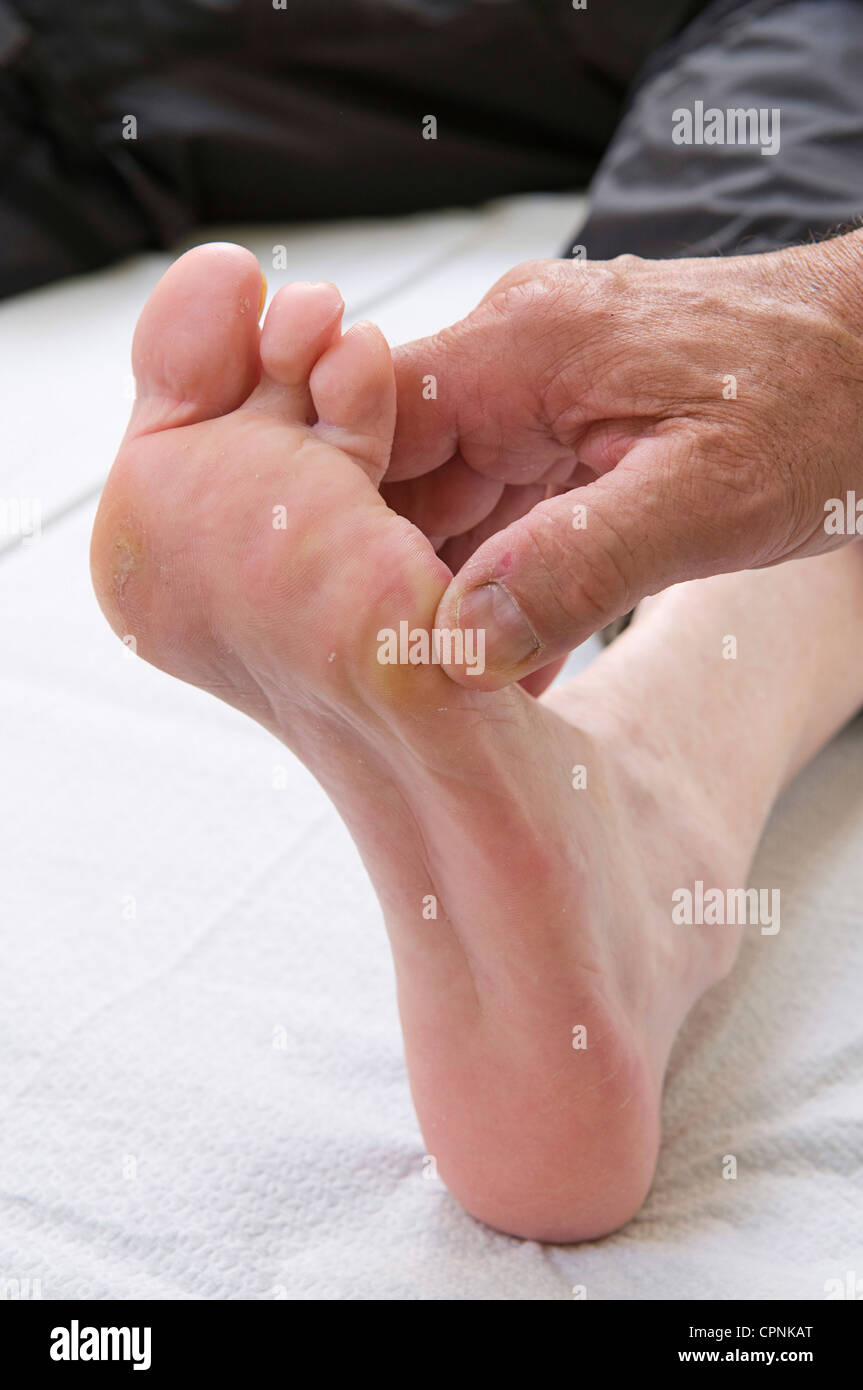 Amputation stump -Fotos und -Bildmaterial in hoher Auflösung - Seite 2 ...