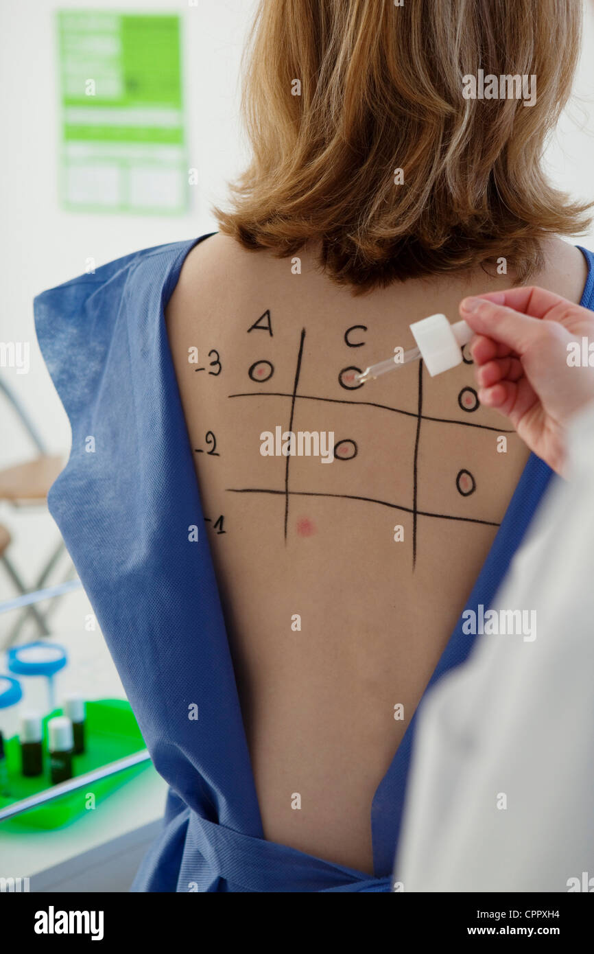 Allergie test -Fotos und -Bildmaterial in hoher Auflösung – Alamy