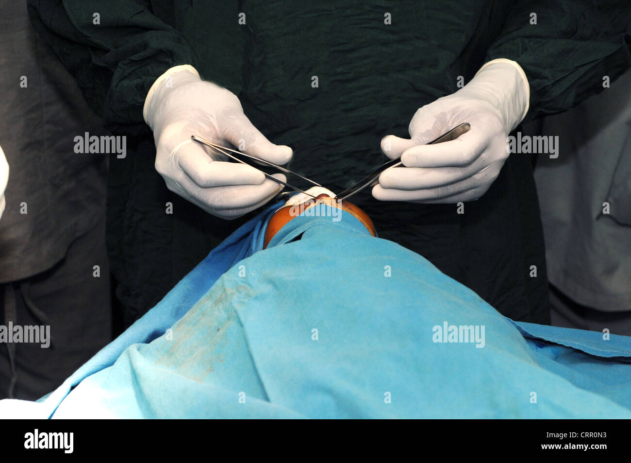 Cleft Palate Stockfotos und -bilder Kaufen - Alamy