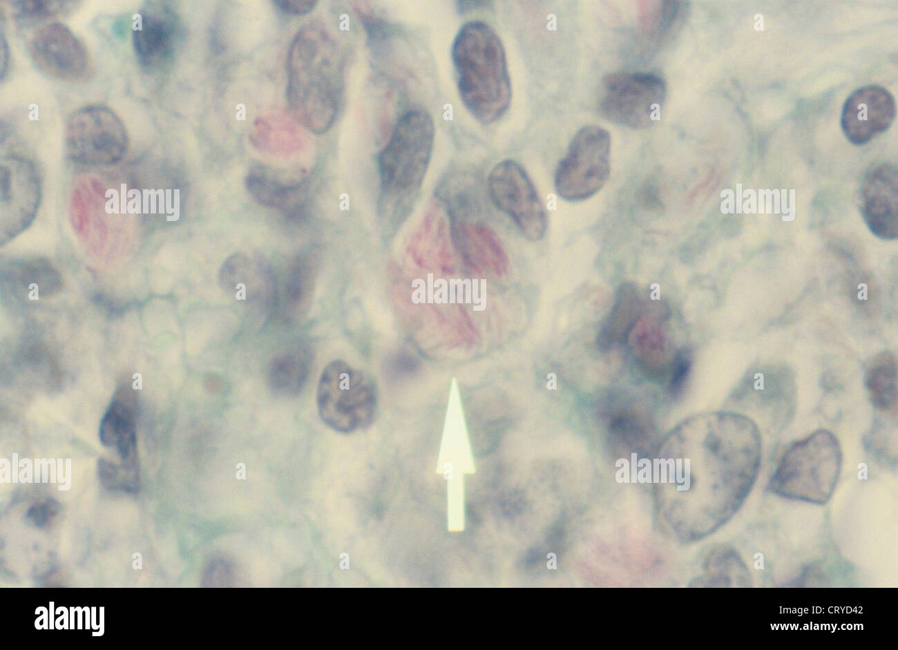 Mycobacterium leprae bacteria -Fotos und -Bildmaterial in hoher ...