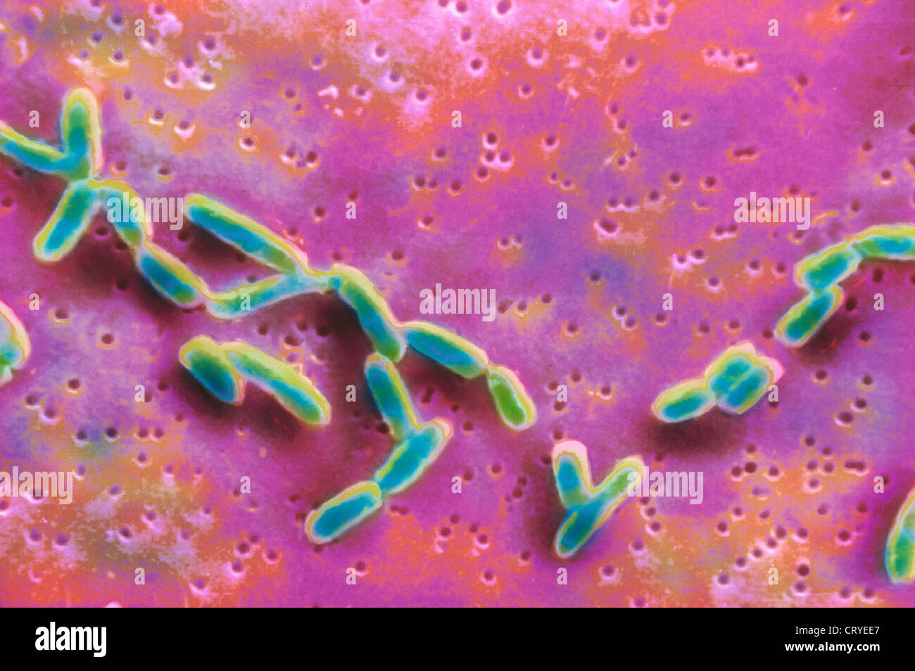 Enterobacter cloacae -Fotos und -Bildmaterial in hoher Auflösung – Alamy