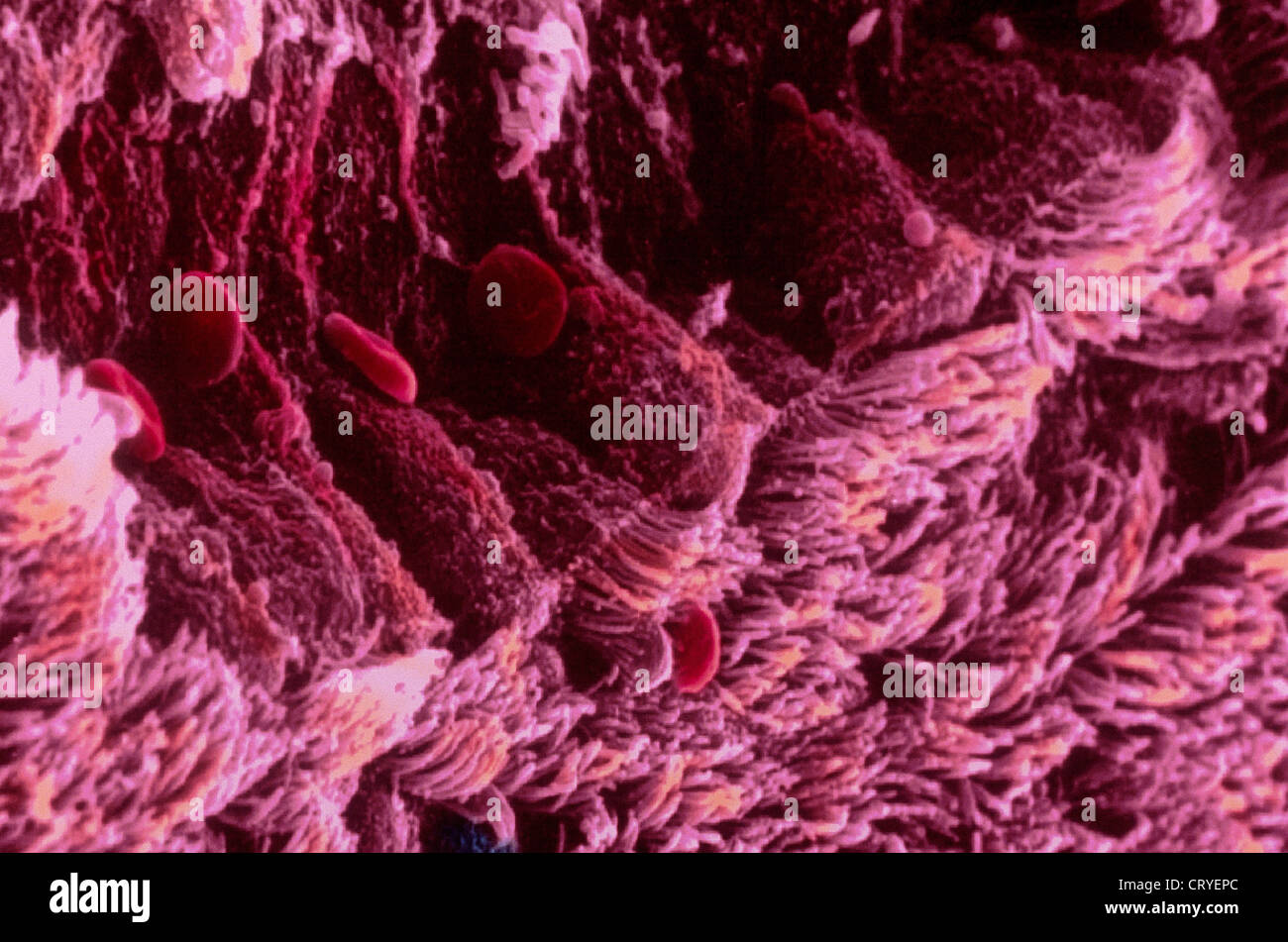 Epitelio respiratorio microscopio -Fotos und -Bildmaterial in hoher ...