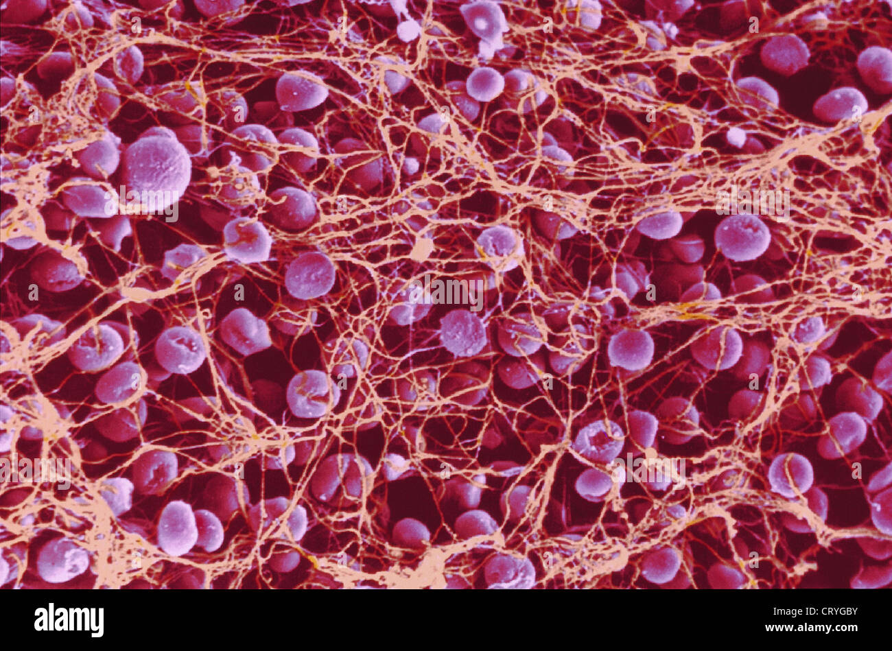 Koagulum fibrin -Fotos und -Bildmaterial in hoher Auflösung – Alamy