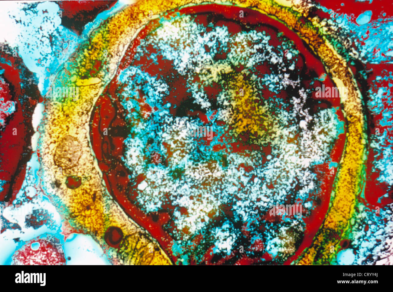 Plasma cell tem -Fotos und -Bildmaterial in hoher Auflösung – Alamy