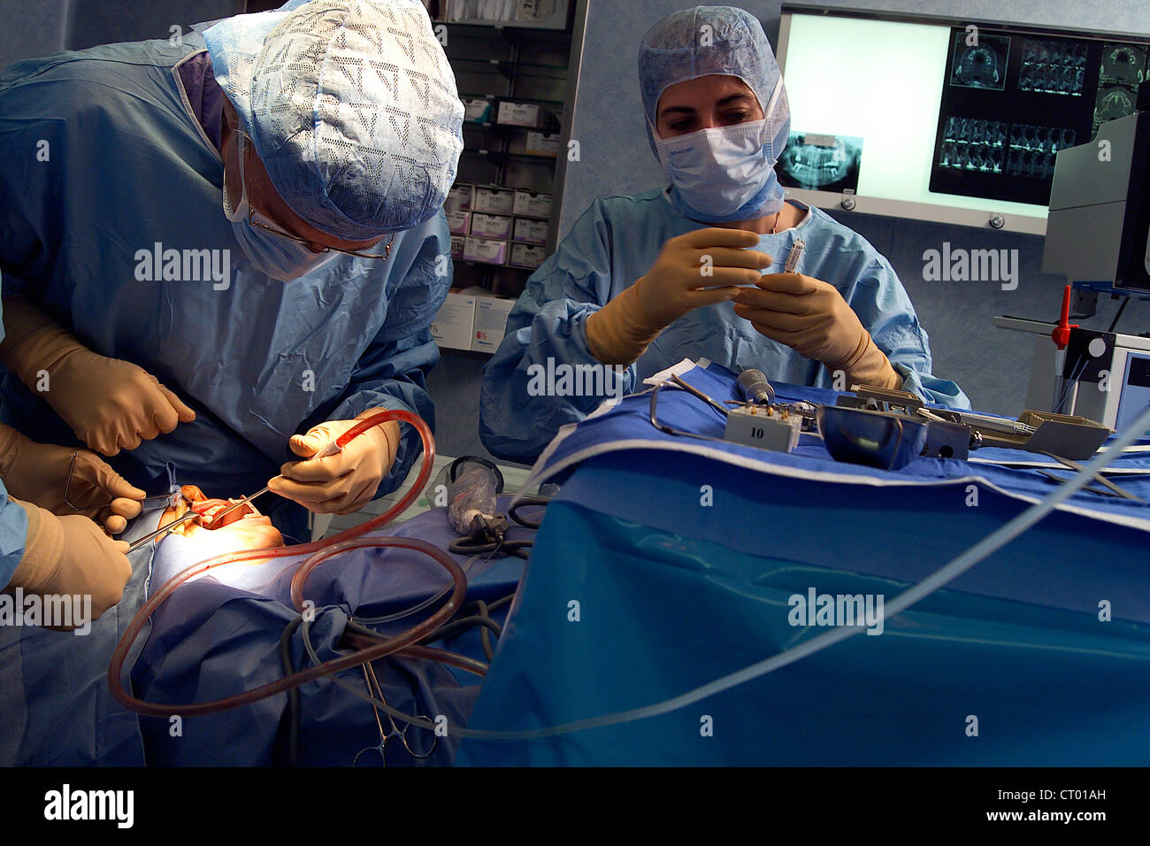 IMPLANTAT ZAHN OPERATION Stockfotografie - Alamy