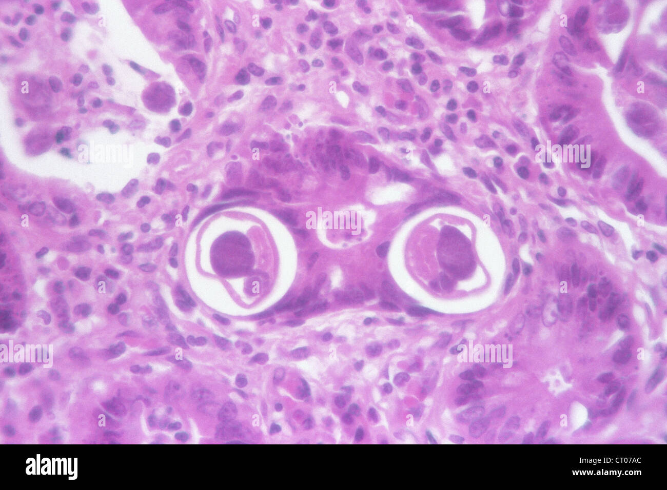 Strongyloides parasiten -Fotos und -Bildmaterial in hoher Auflösung – Alamy