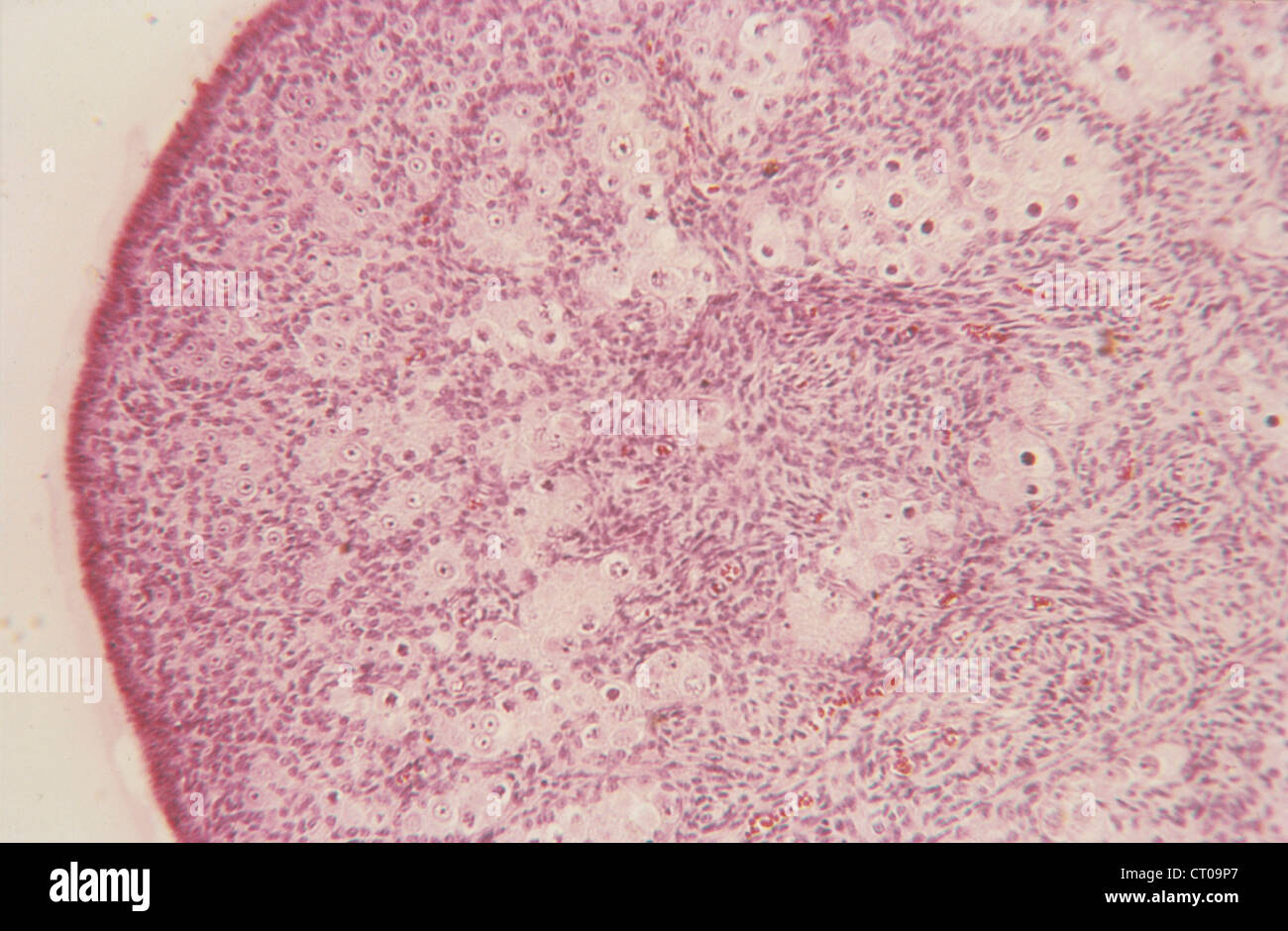 Ovarian follicle histology -Fotos und -Bildmaterial in hoher Auflösung ...