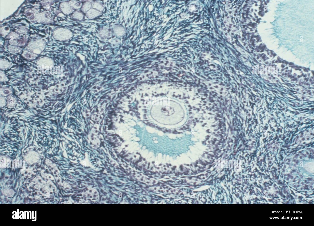 Ovarian follicle histology -Fotos und -Bildmaterial in hoher Auflösung ...