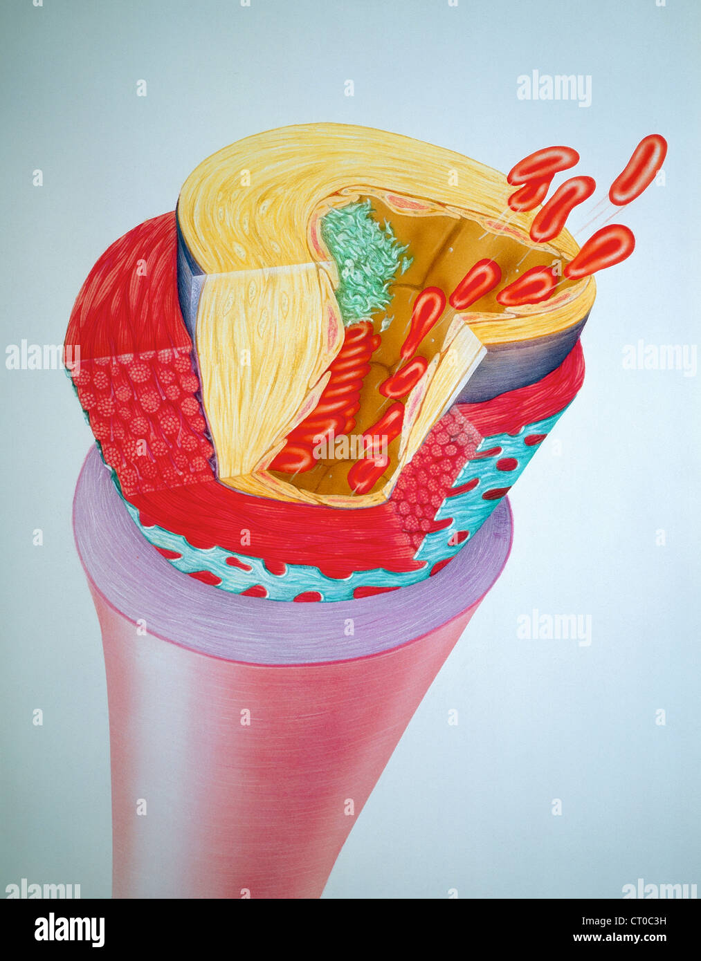 Arterielle thrombose -Fotos und -Bildmaterial in hoher Auflösung – Alamy